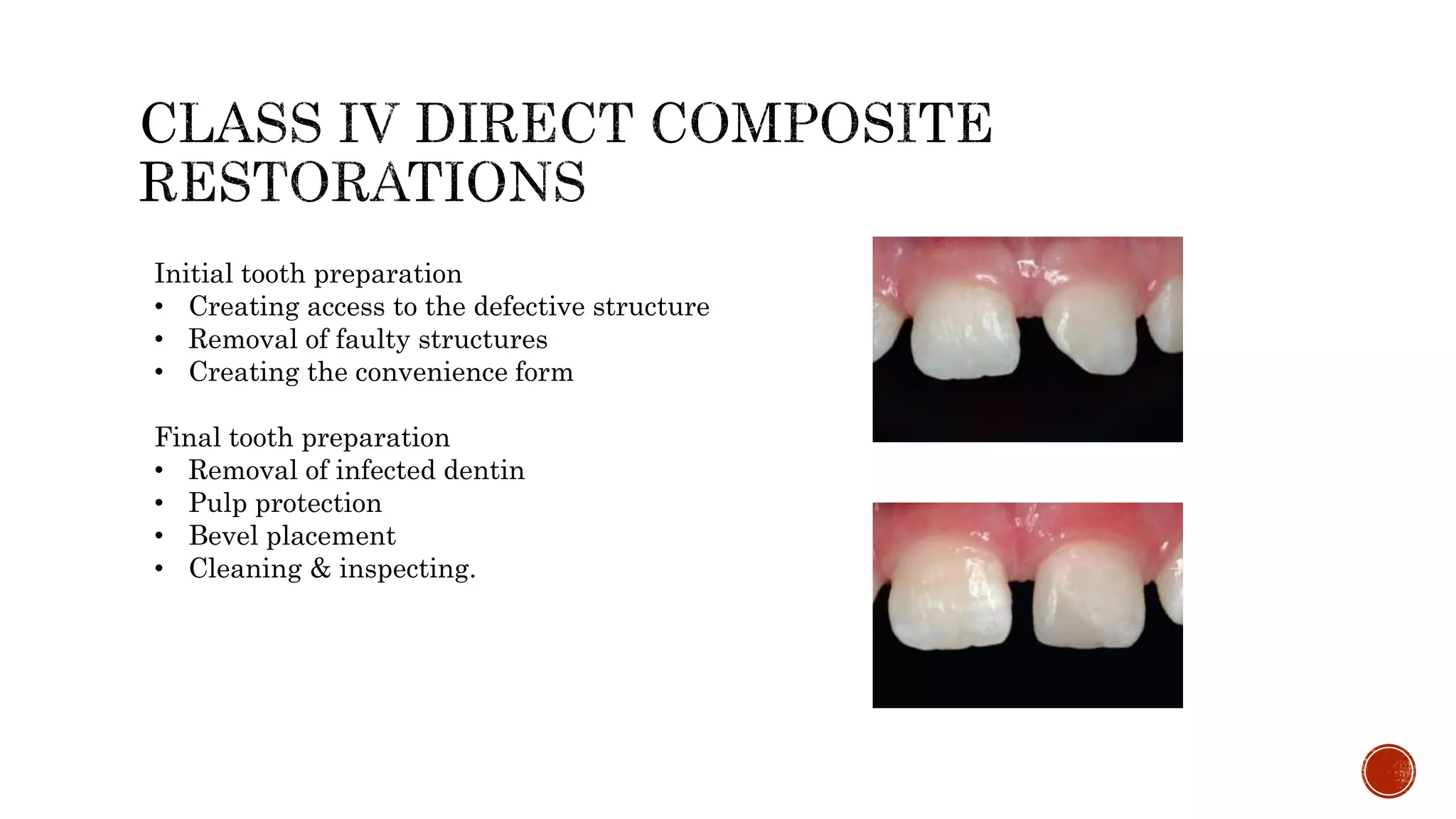 Composite Resins Part Ii Ppt