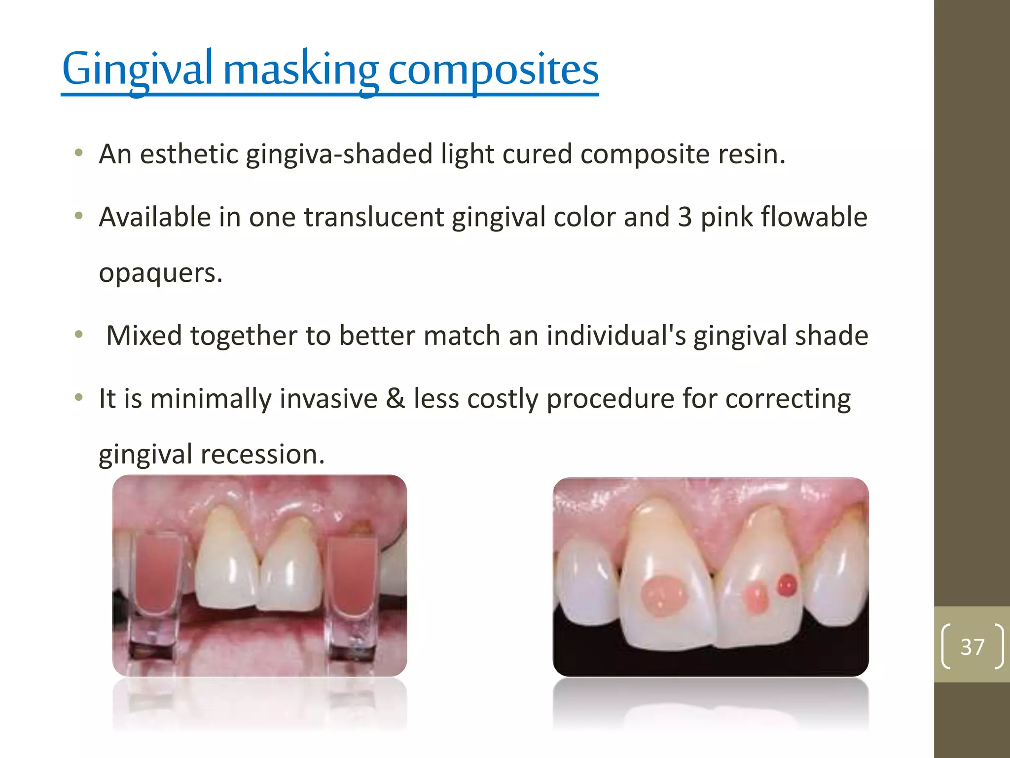 Composite resins part ii | PPTX