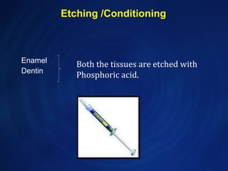 Composite resin technique | PPT