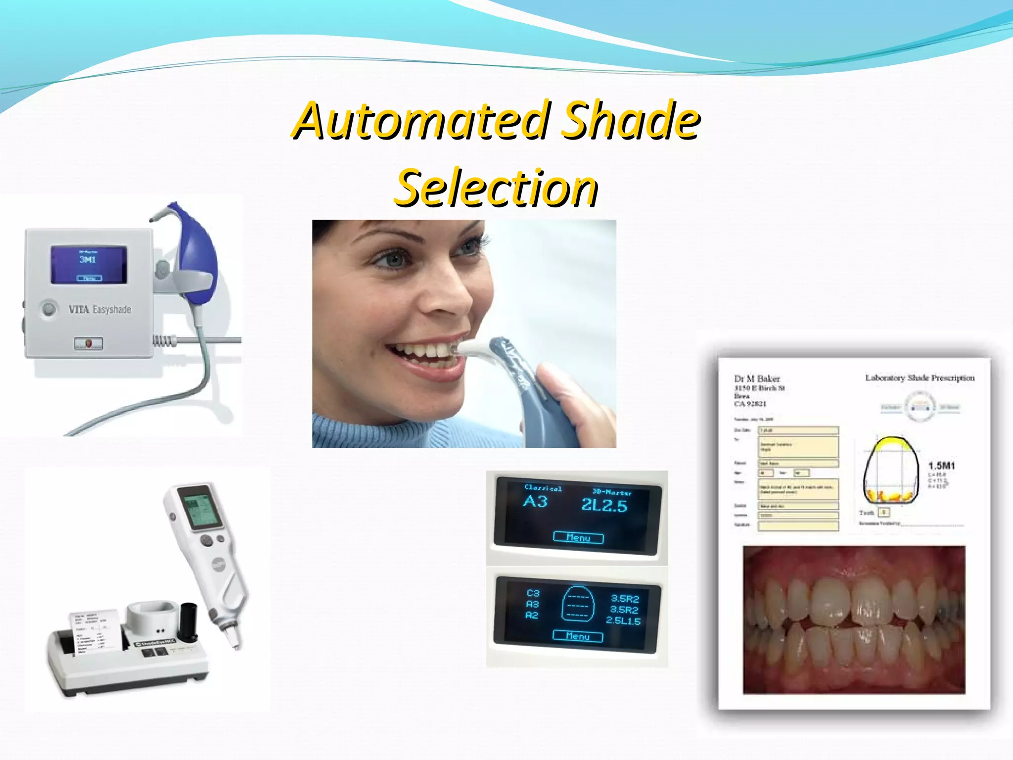 Composite restoration | PPT