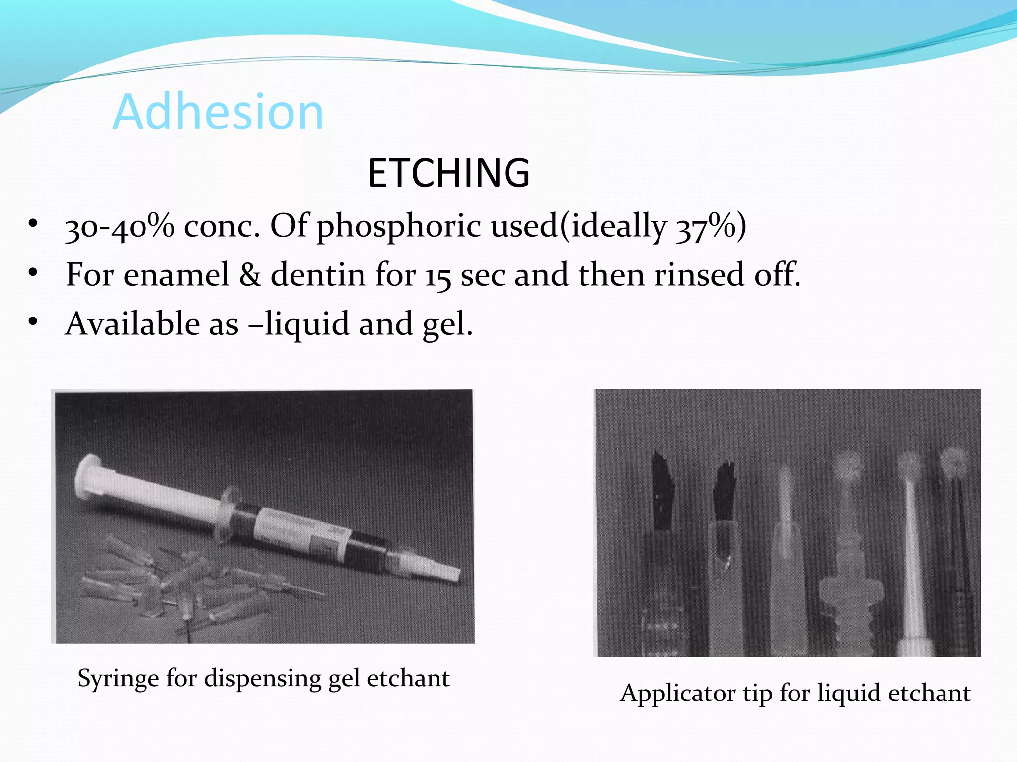 Composite restoration | PPT