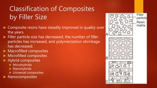 Composites and Compomers: Part 1 | PPTX