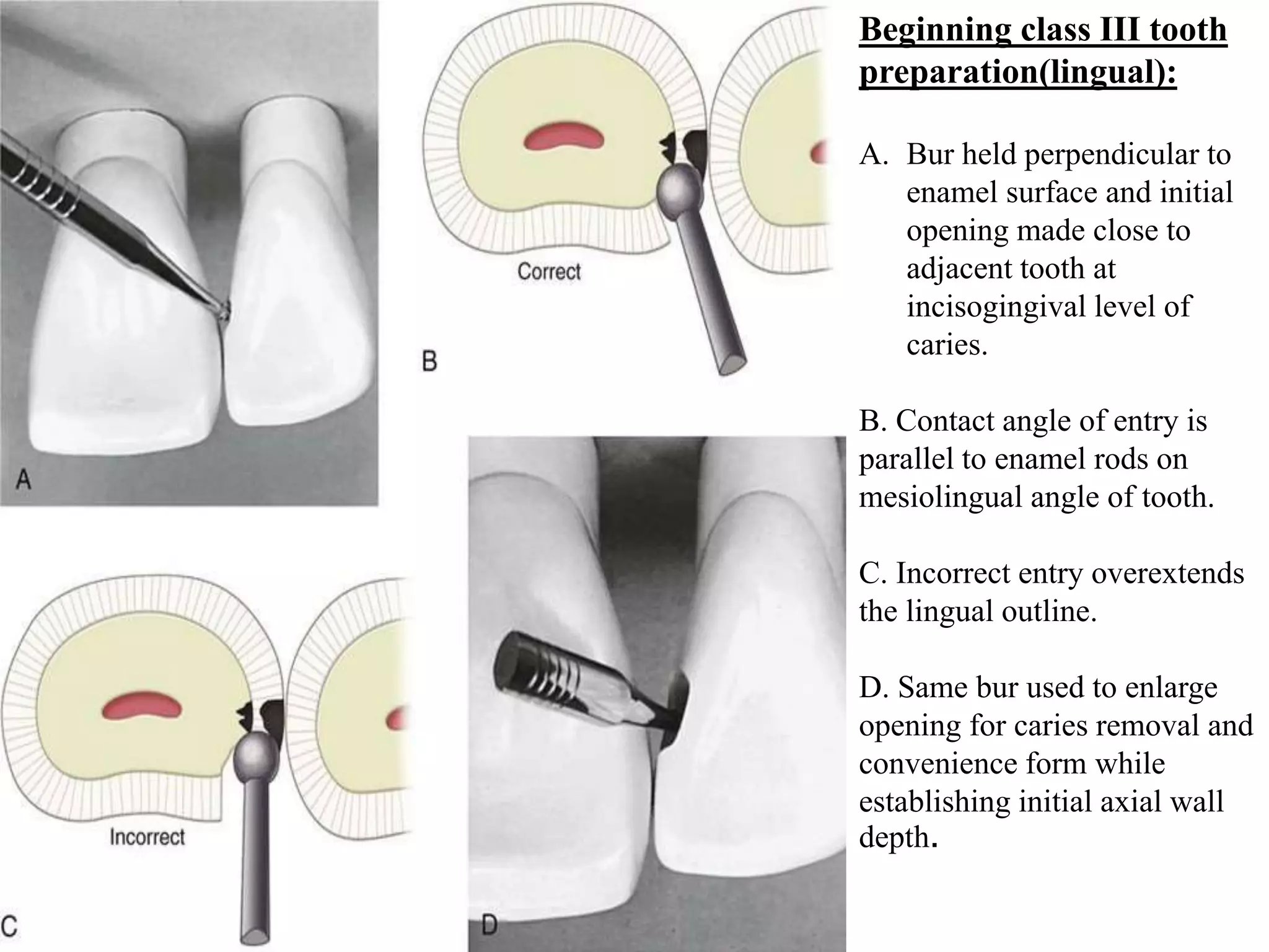 Composite class 3 and class 5 | PPTX