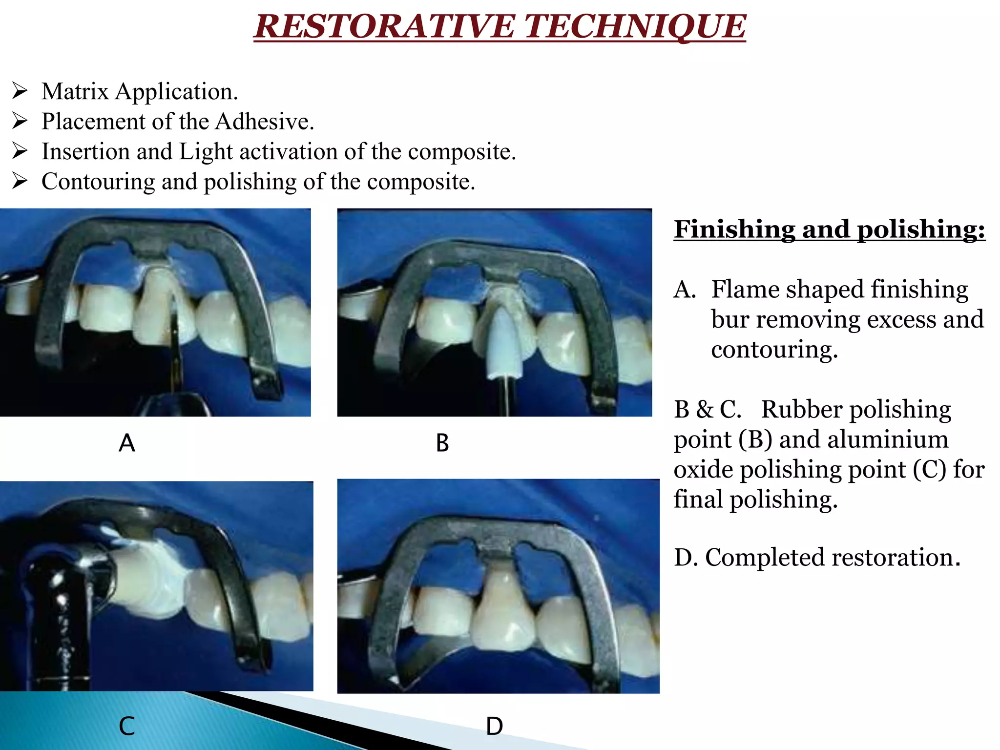Composite class 3 and class 5 | PPTX