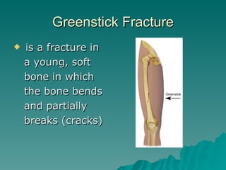 Compound Fracture, Impacted Fracture, Greenstick Fracture | PPT