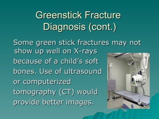 Compound Fracture, Impacted Fracture, Greenstick Fracture | PPT