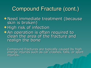 Compound Fracture, Impacted Fracture, Greenstick Fracture | PPT