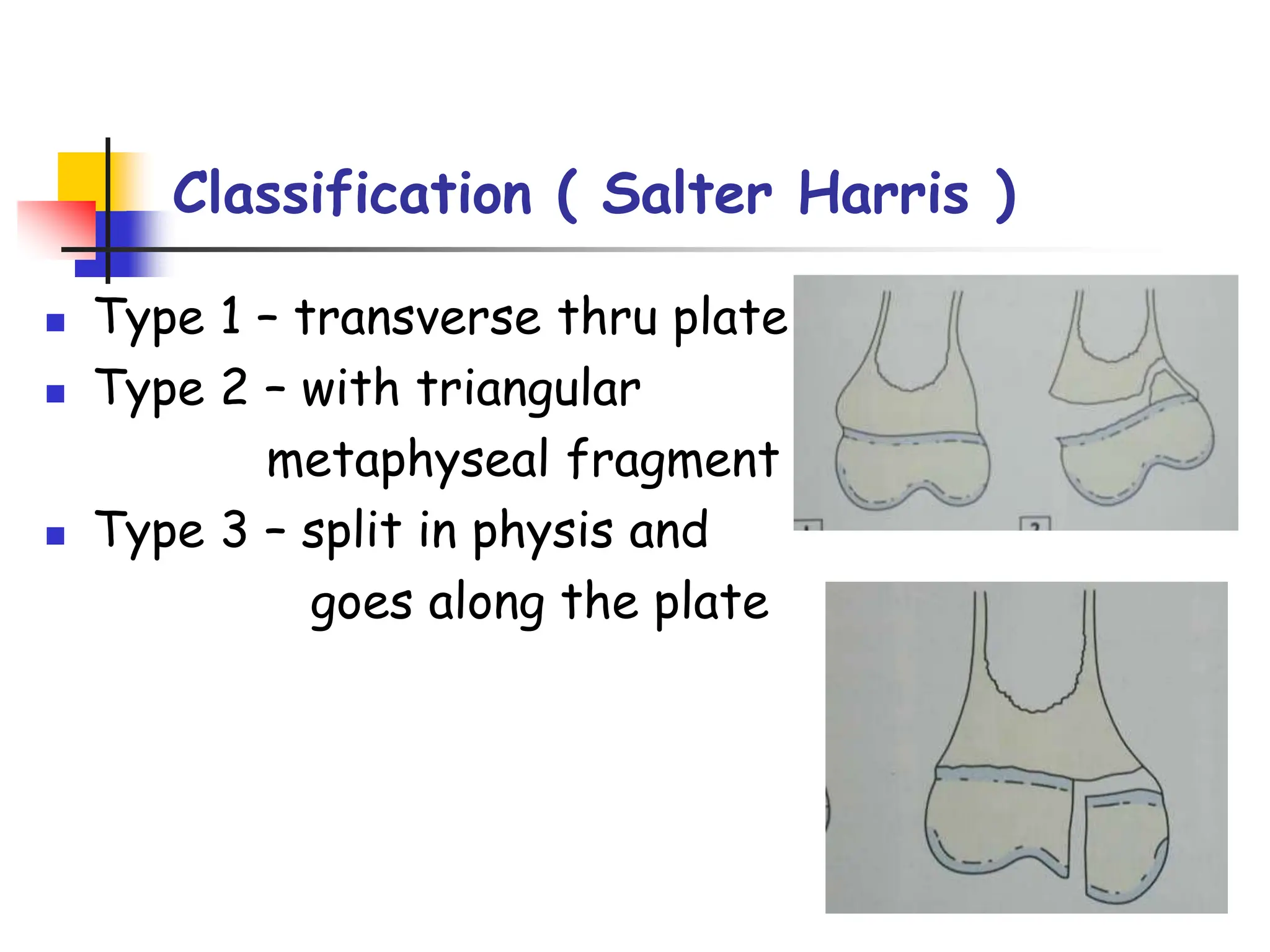 COMPOUND FRACTURES principles and management | PPT