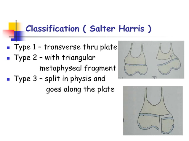 COMPOUND FRACTURES principles and management | PPT