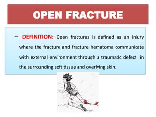 compound injuries management in trauma patients | PPTX