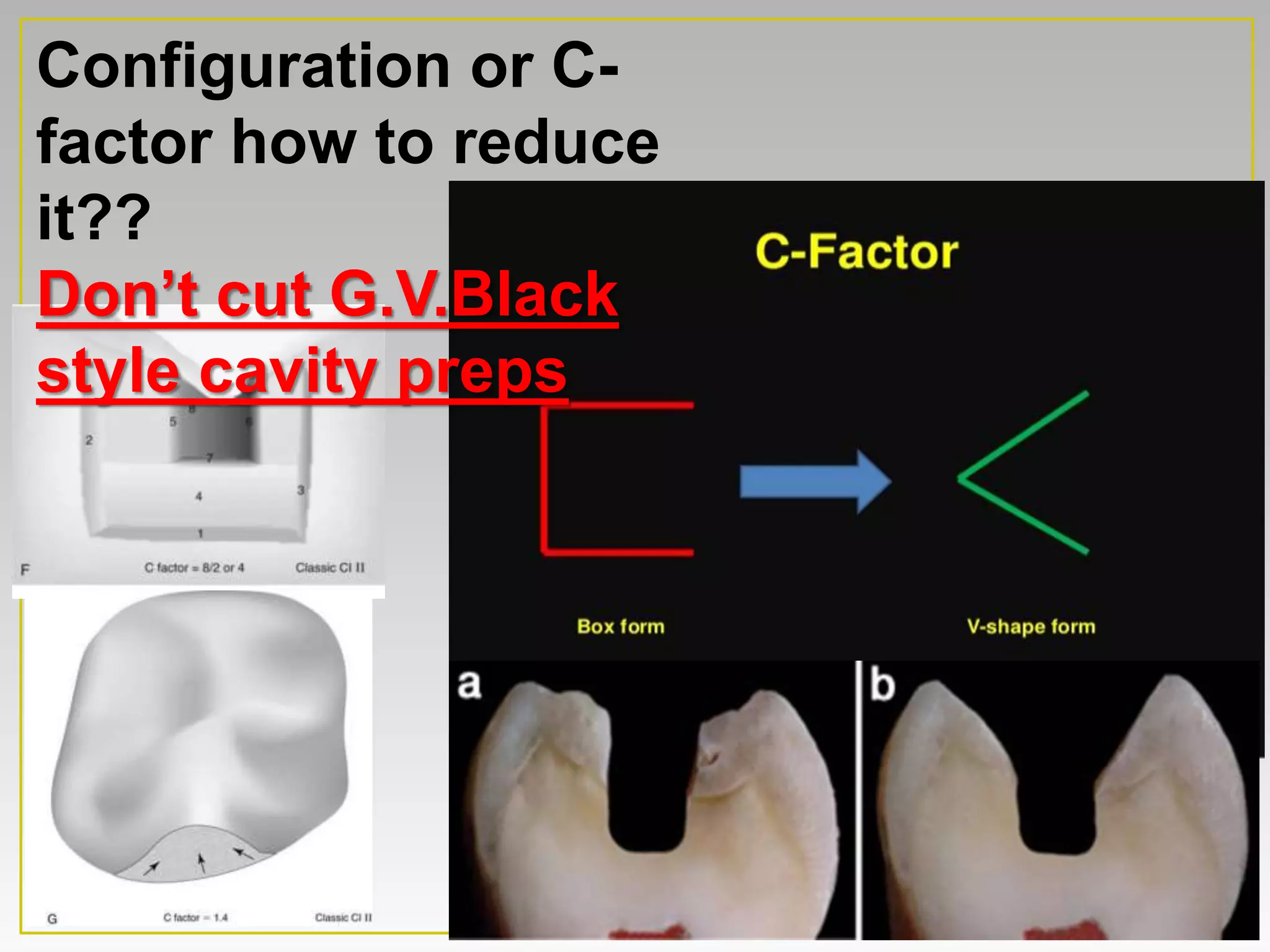 Direct Posterior Composite restoration | PPTX