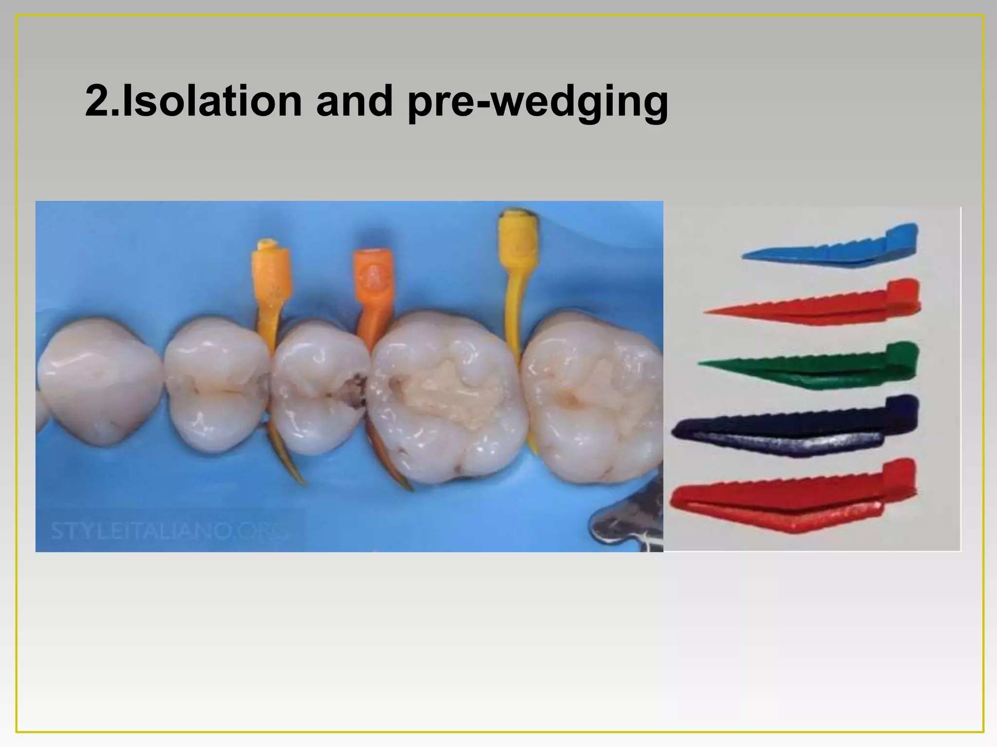 Direct Posterior Composite restoration | PPTX