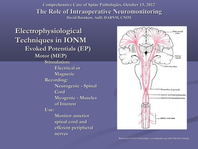 The Role of Intraoperative Neuromonitoring (IONM) | PPT