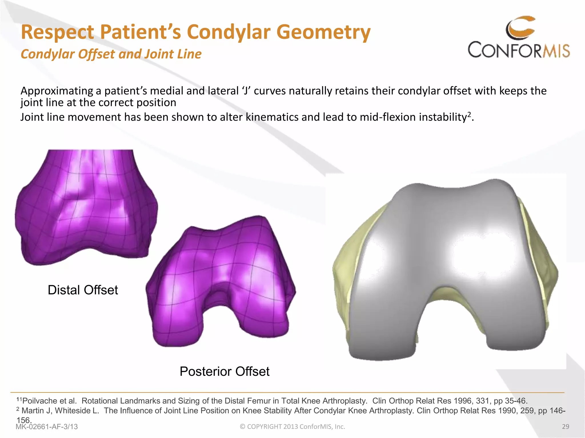 Conformis Patient Specific Custom Total Knee Replacement | PPTX