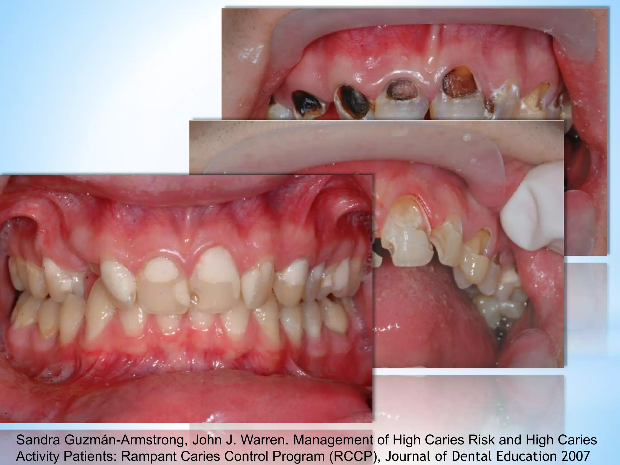 Comprehensive Dental Care | PPTX