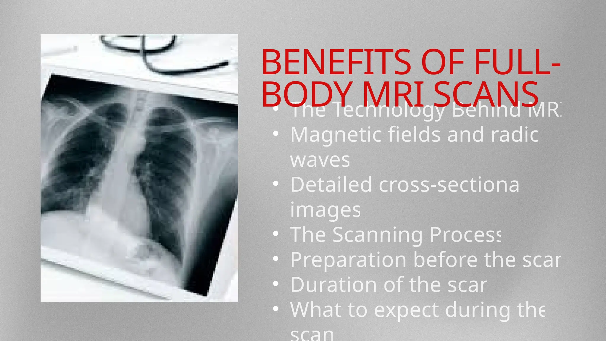 Comprehensive Guide to Full-Body MRI Scans sanjivinidiagnostics | PPTX