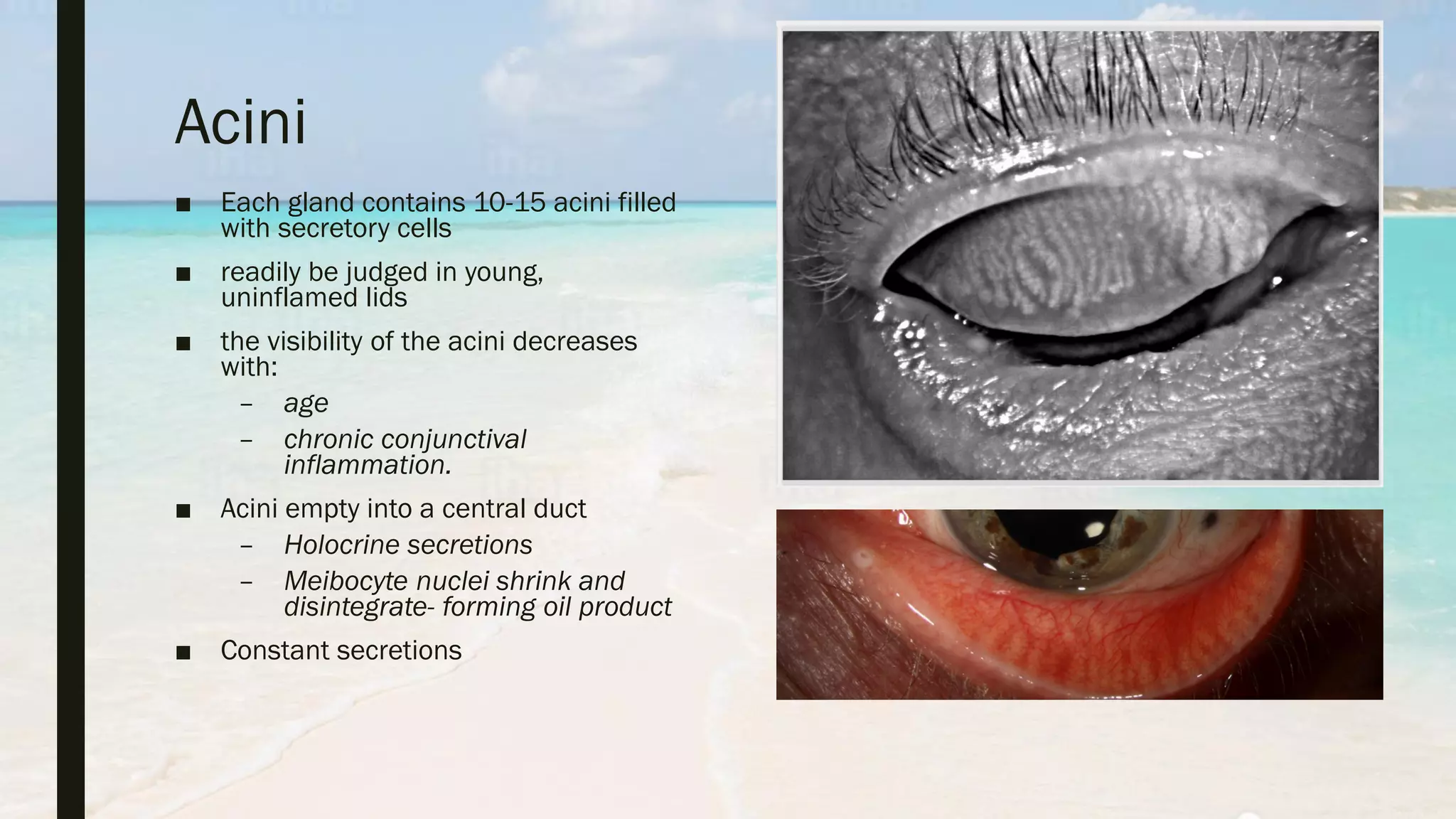 Comprehensive meibomian gland evaluation | PDF