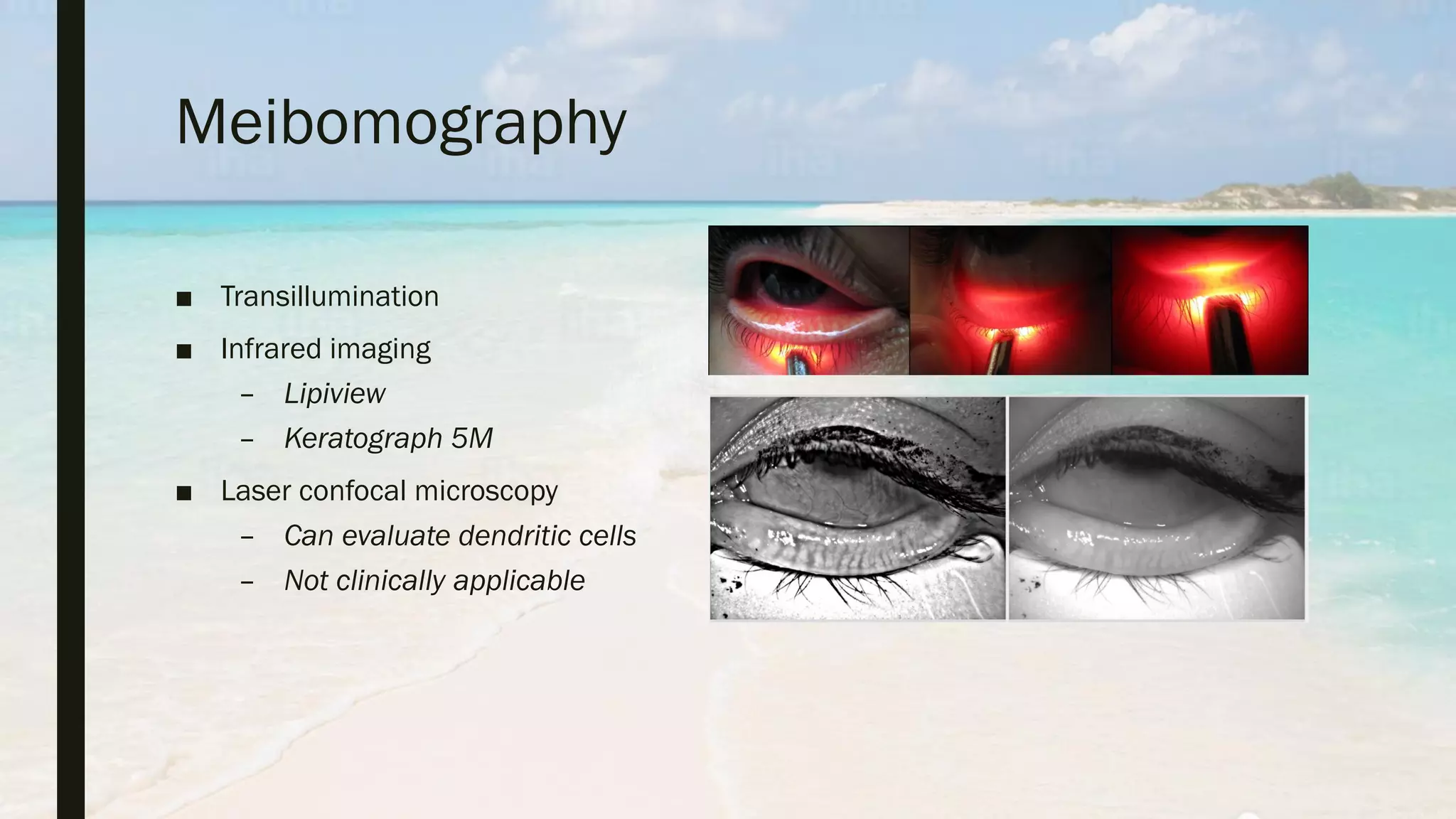 Comprehensive meibomian gland evaluation | PDF