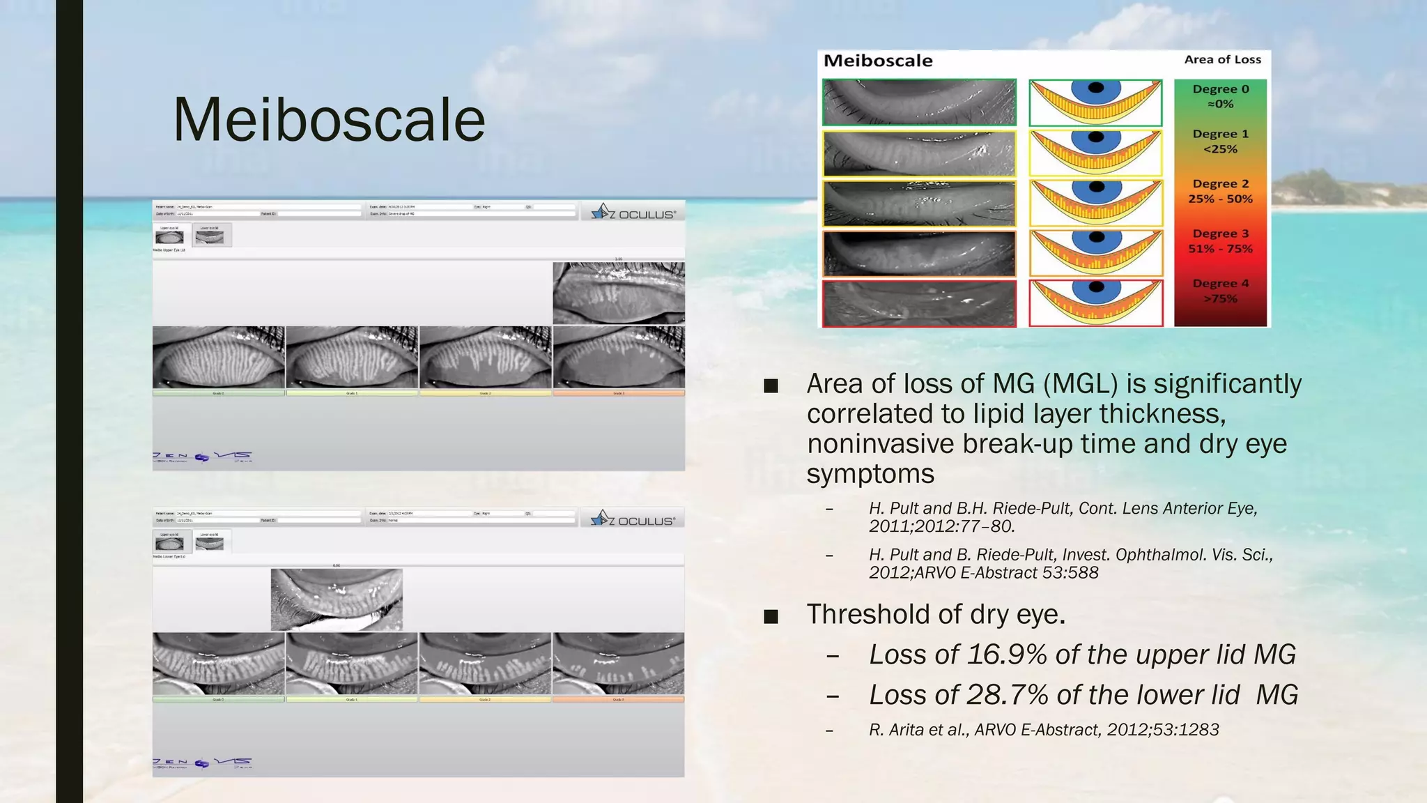 Comprehensive meibomian gland evaluation | PDF