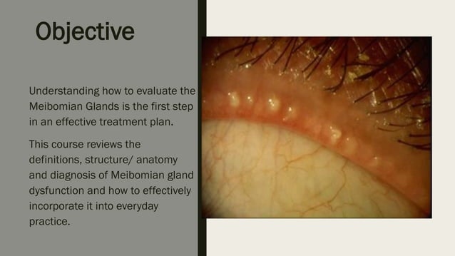 Comprehensive meibomian gland evaluation | PDF