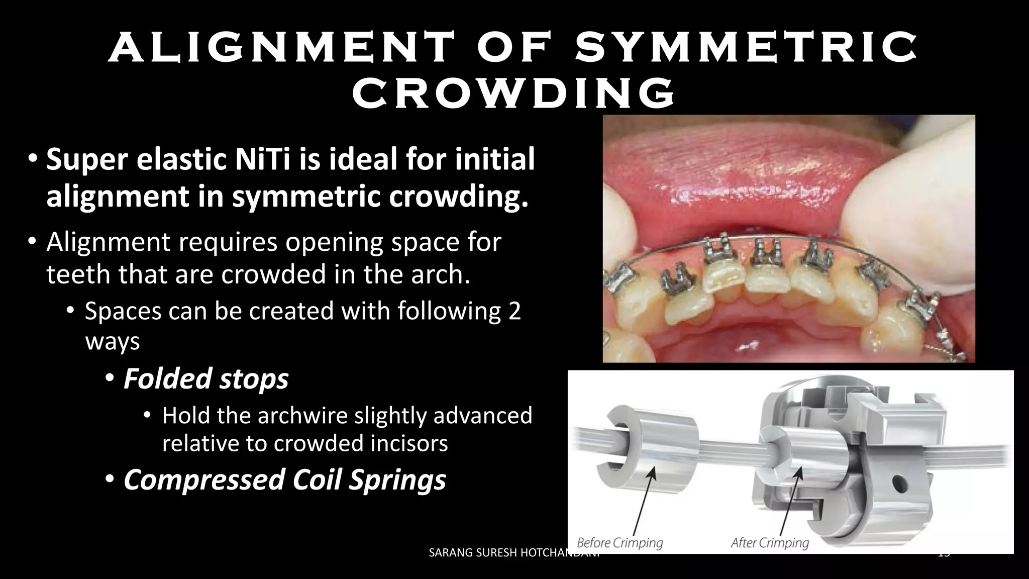Comprehensive Orthodontic Treatment in the Early Permanent Dentition | PDF