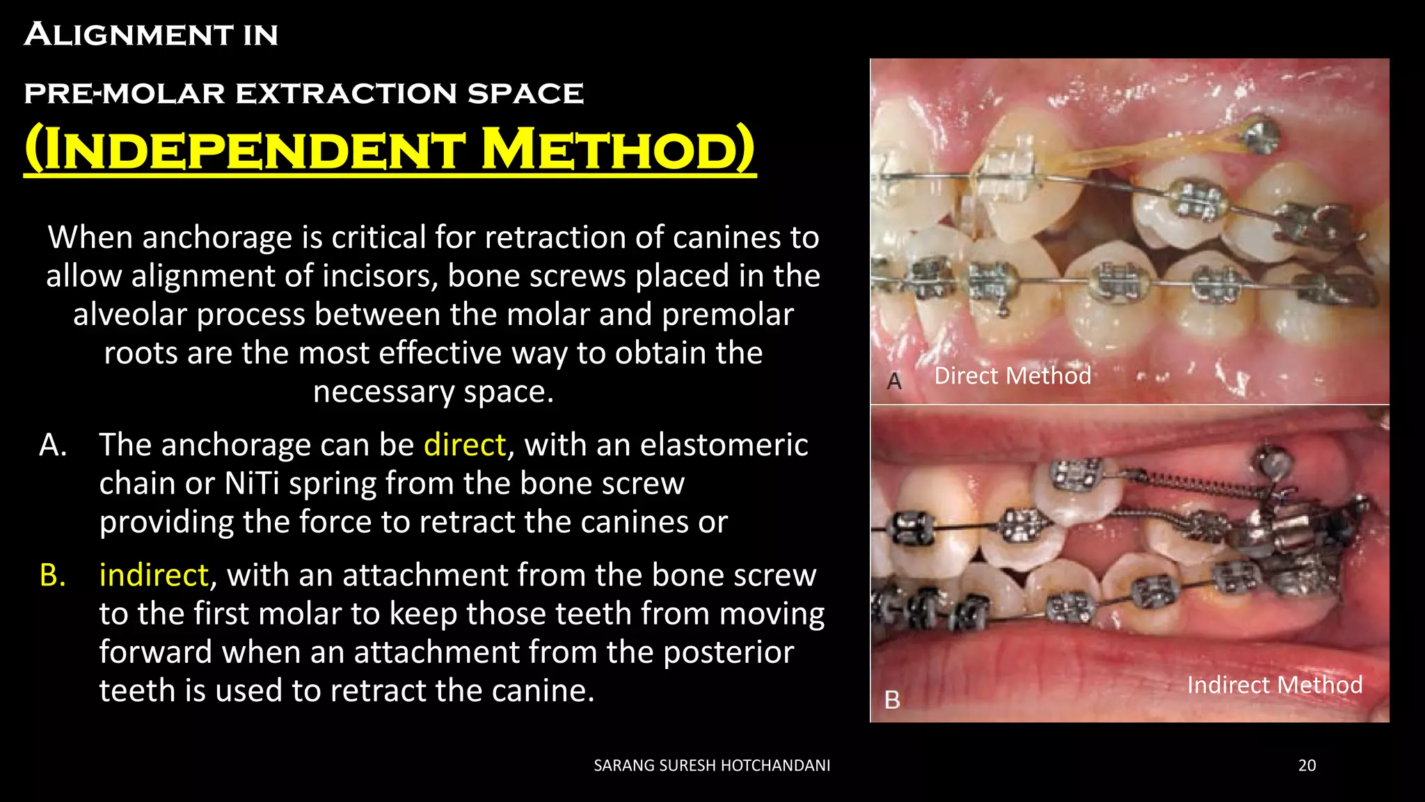 Comprehensive Orthodontic Treatment in the Early Permanent Dentition | PDF