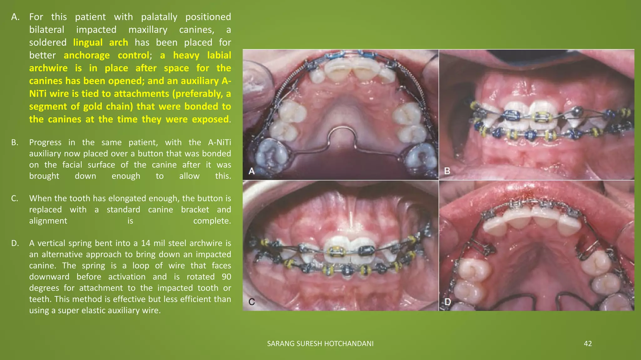 Comprehensive Orthodontic Treatment in the Early Permanent Dentition | PDF