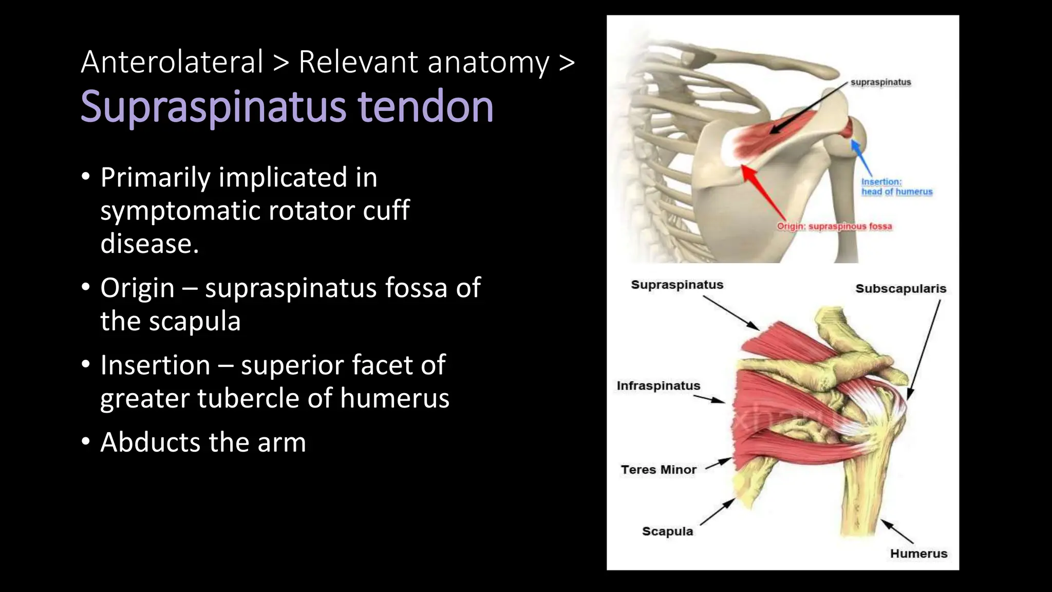 Comprehensive Shoulder US Examination.pptx