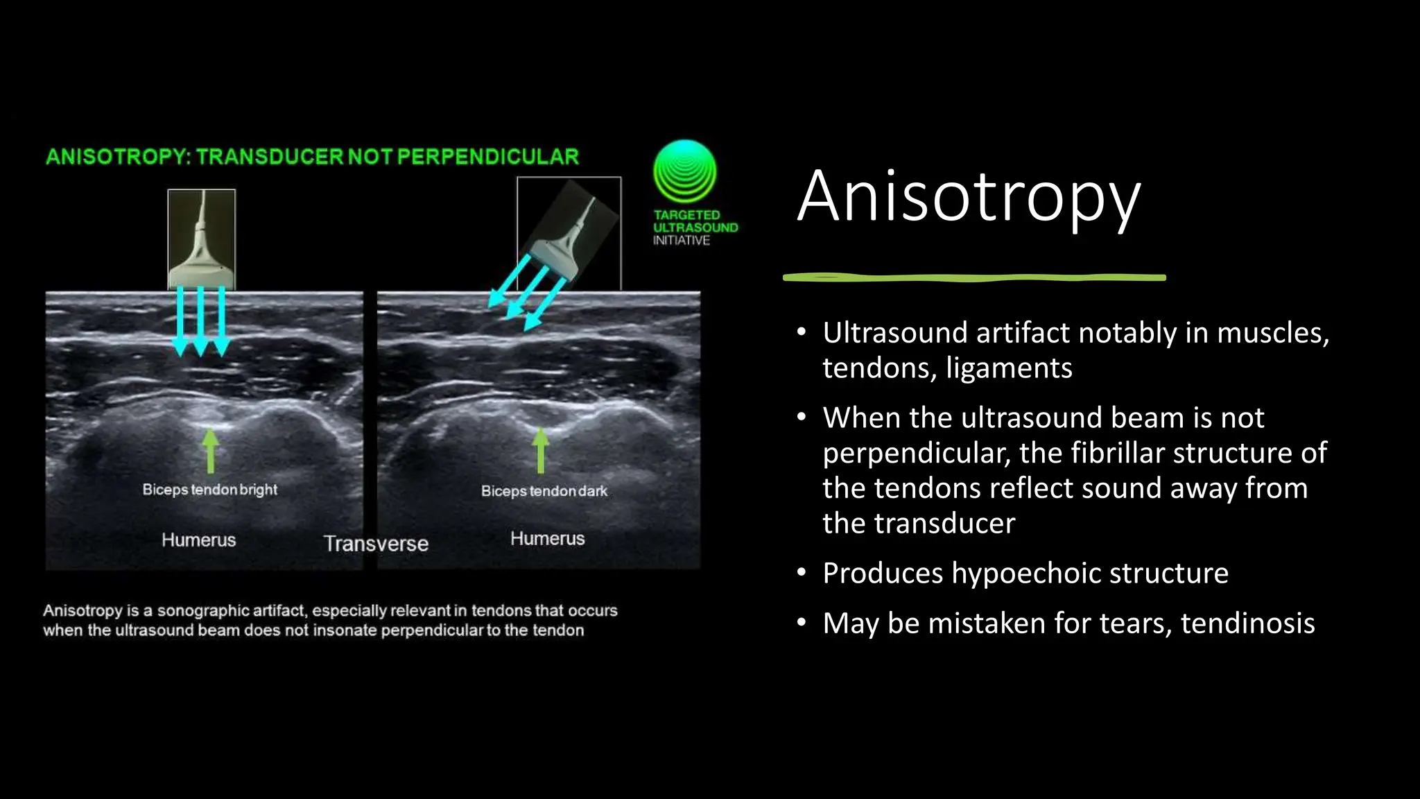 Comprehensive Shoulder US Examination.pptx