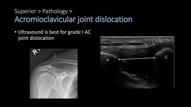 Comprehensive Shoulder US Examination.pptx