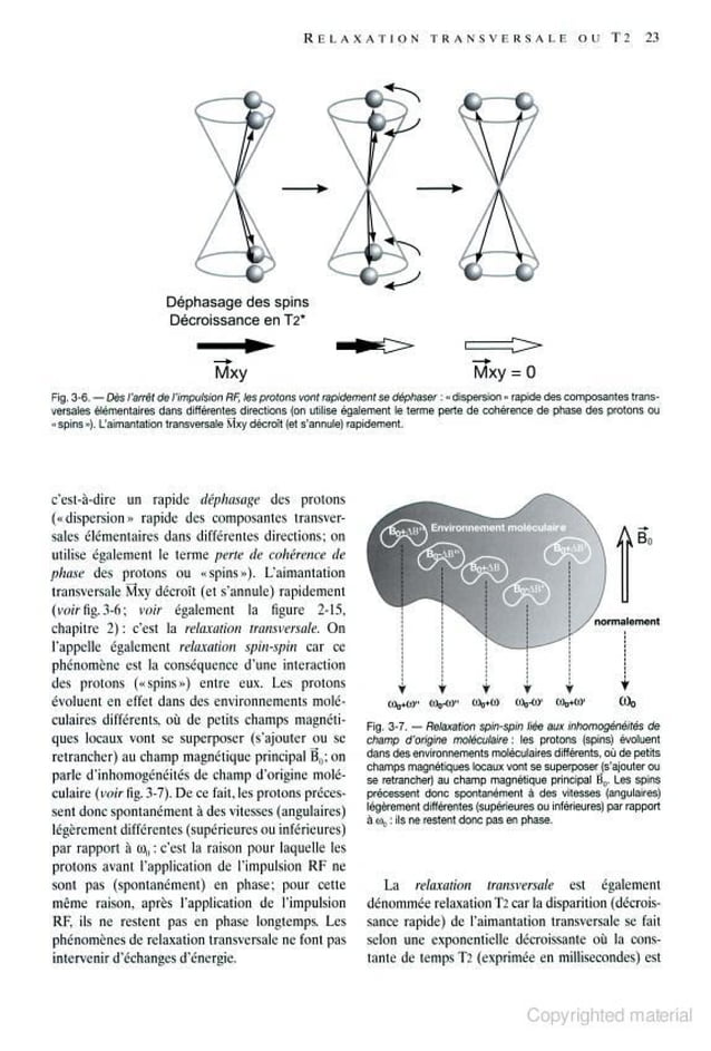 Comprendre l'irm | PDF
