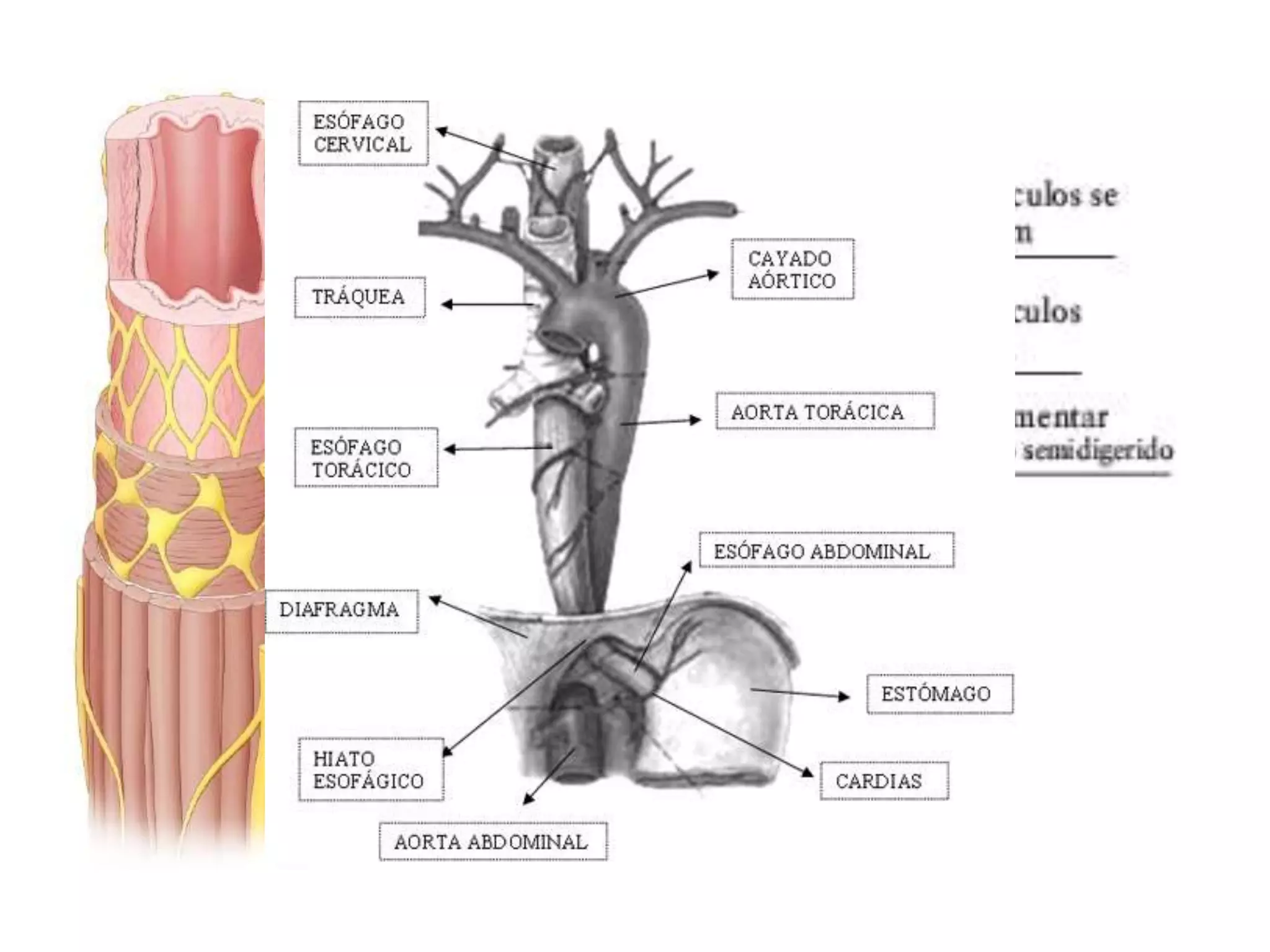MALFORMACIONES ANATOMICAS DEL ESOFAGO | PPT
