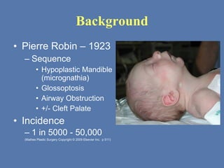 Compressed Quantitative Results Of Mandibular Distraction Osteogenesis ...