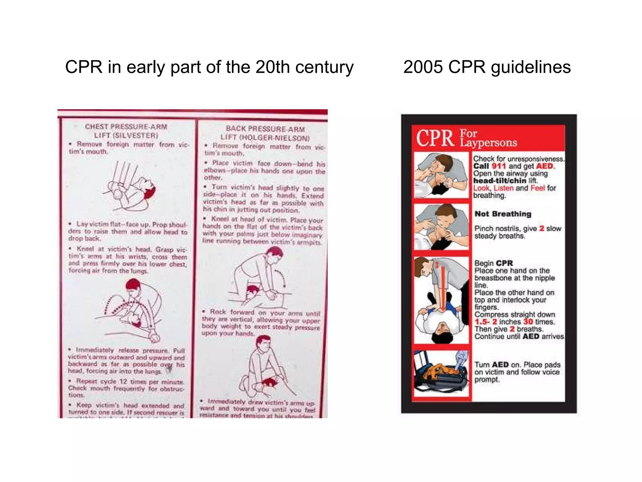 Compression only CPR | PPT