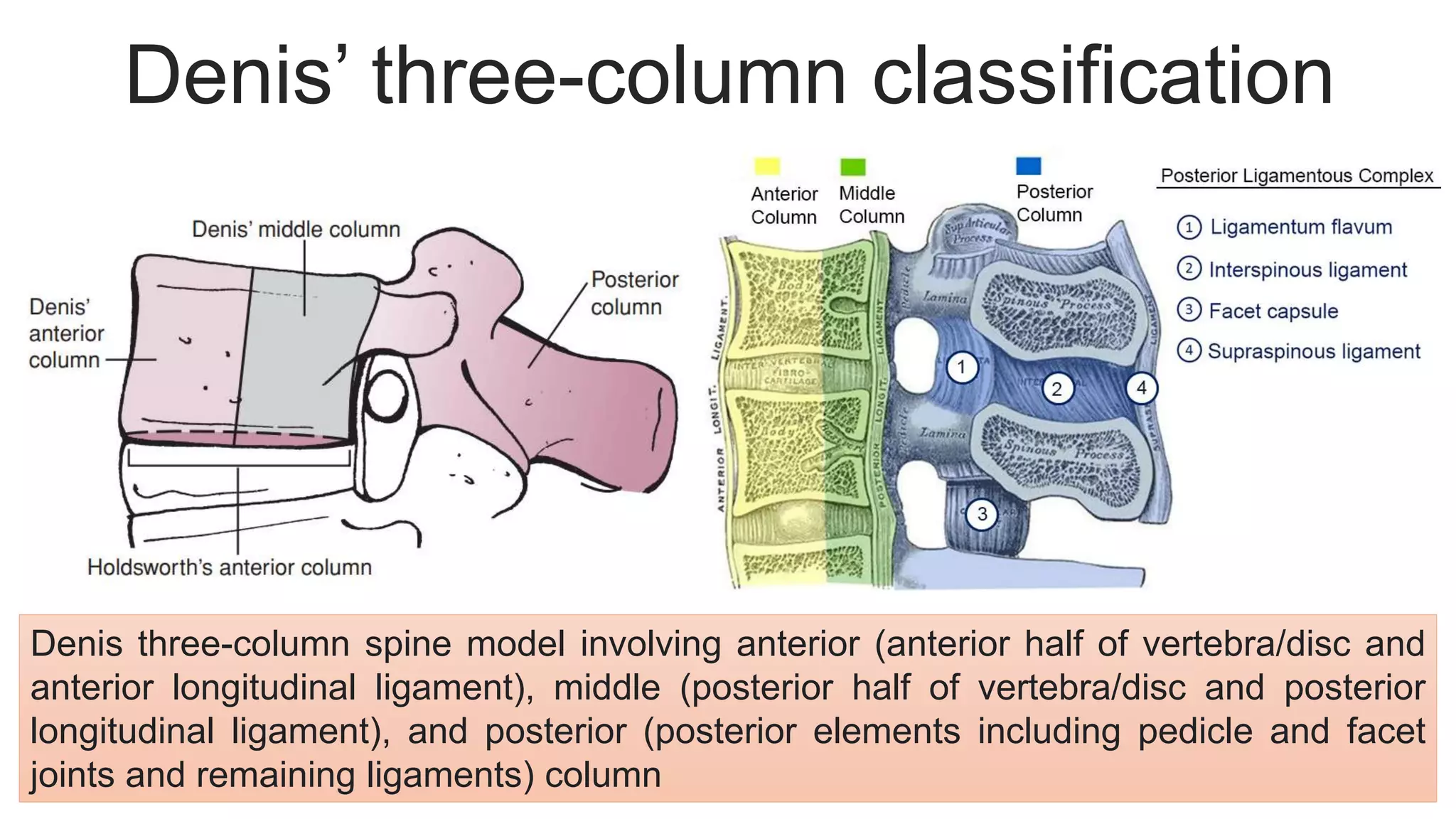 Compression Fracture of Vertebrae Lumbar IV-V.pptx