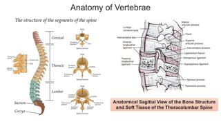 Compression Fracture of Vertebrae Lumbar IV-V.pptx | Death, Injury, or Military Conflict ...