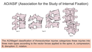 Compression Fracture of Vertebrae Lumbar IV-V.pptx