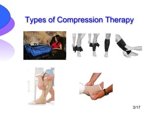 Compression & Leg Ulcers from www.maximedtherapy.com | First Aid | Injuries