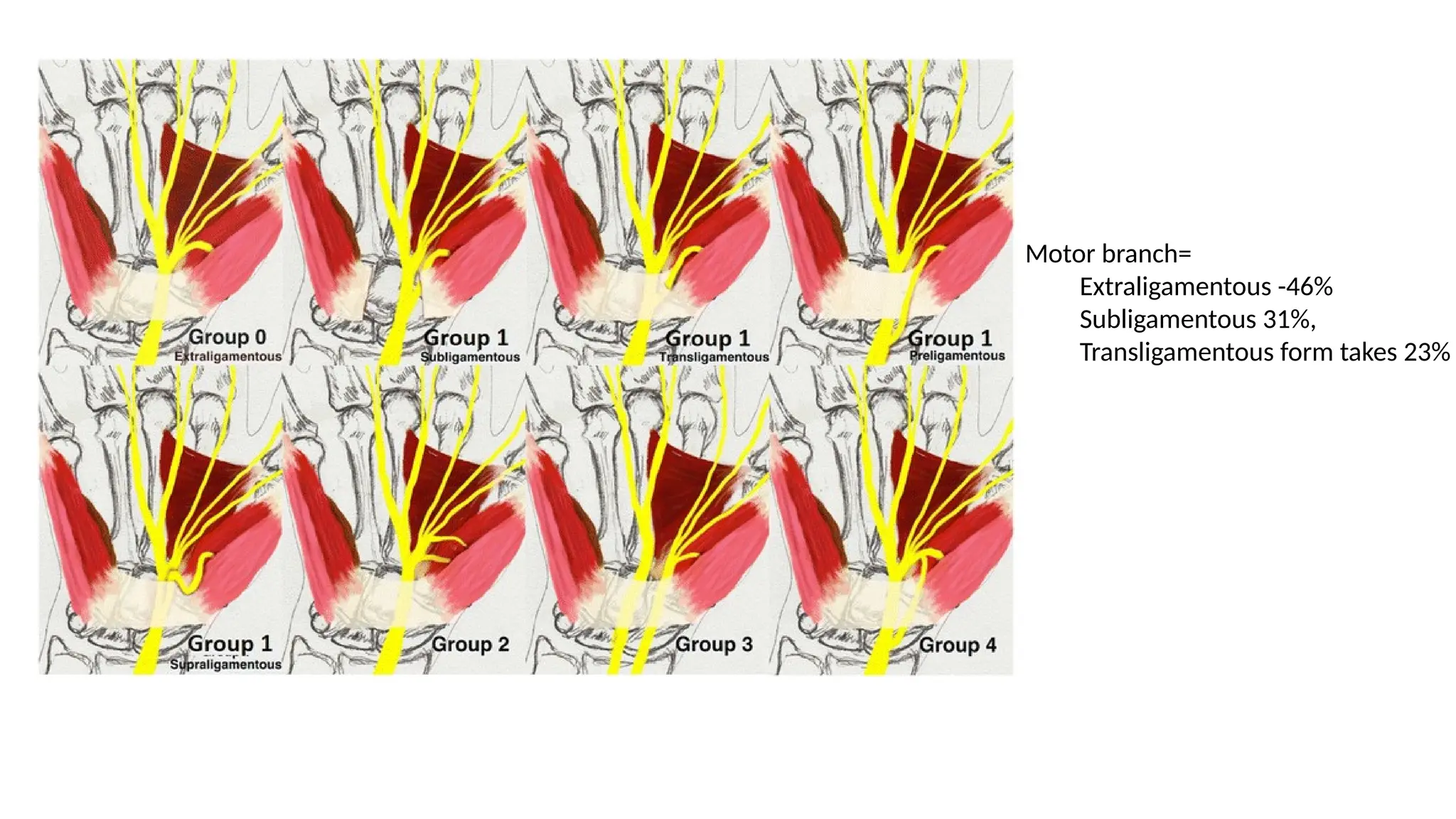 protocols for the management ofcompression neuropathy.pptx