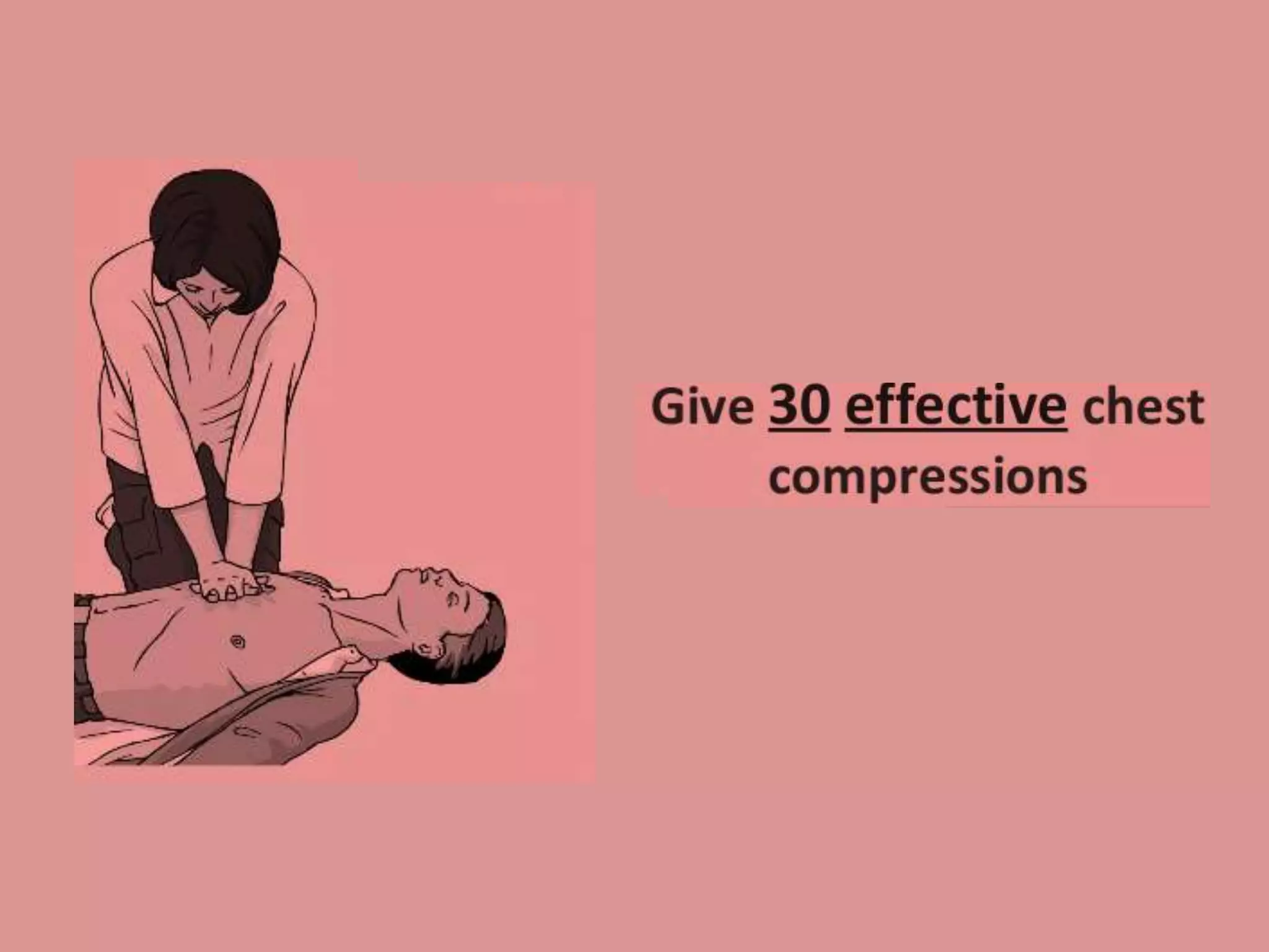 Compression only life support (cols) by tushar chokshi | PPTX