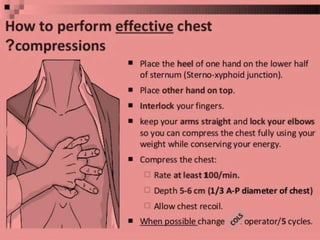 Compression only life support (cols) by tushar chokshi | PPTX
