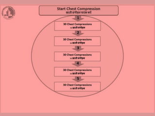 Compression only life support (cols) by tushar chokshi | PPTX