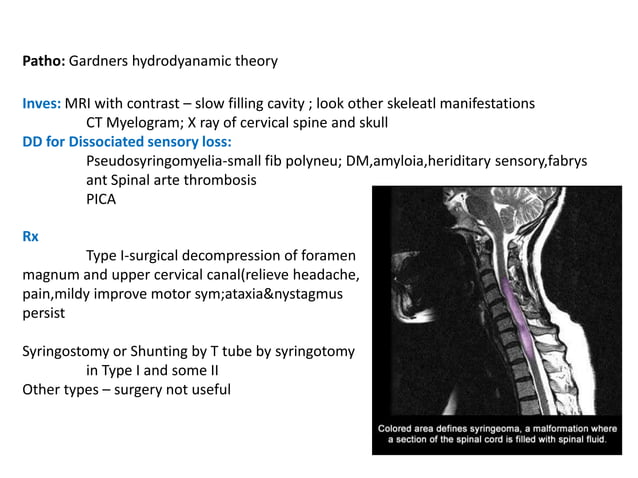Compressive Myelopathy | PPTX | Death, Injury, or Military Conflict ...