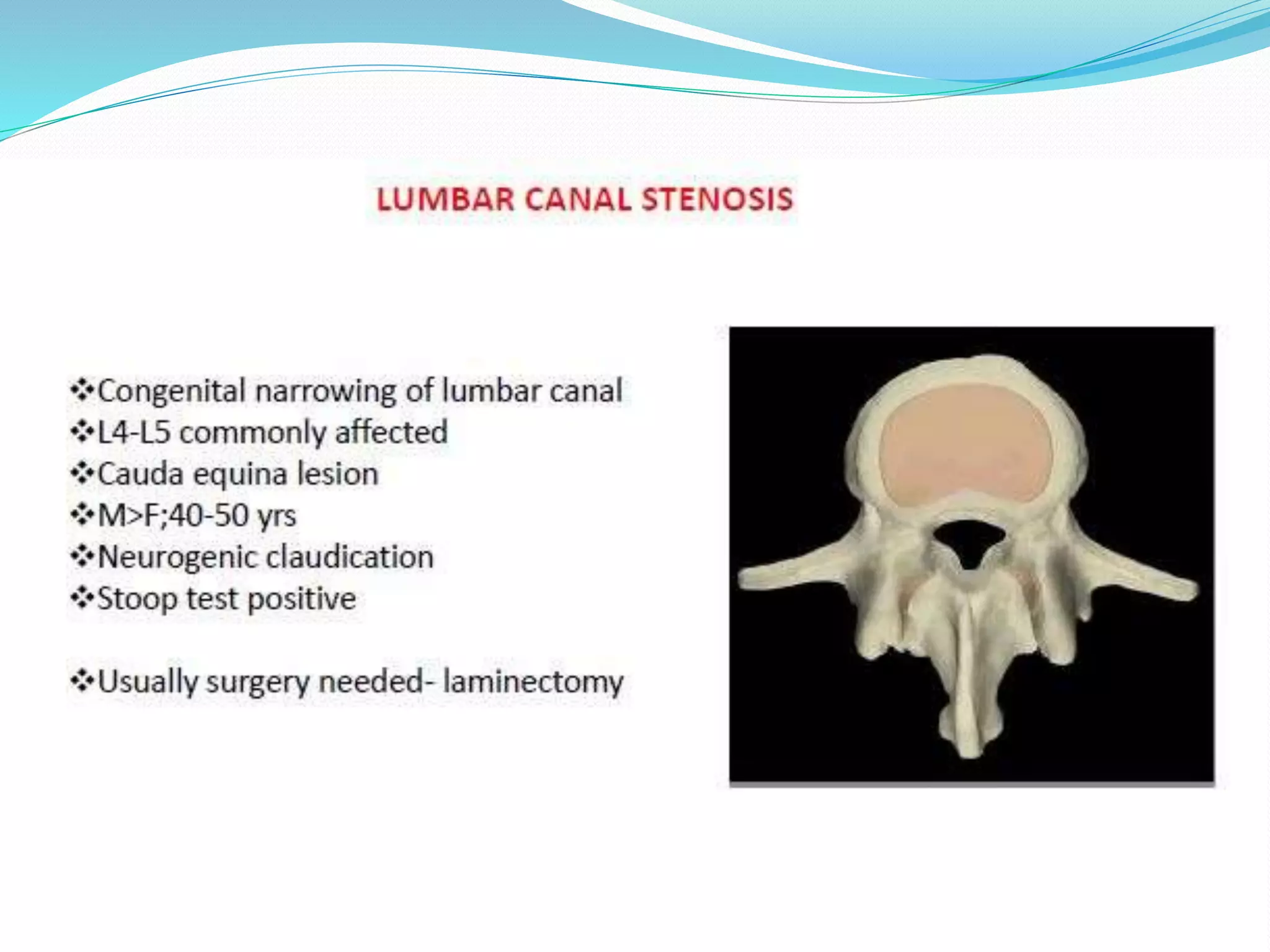 Compressive myelopathy - Etiology, Pathogenesis, Clinical Features ...
