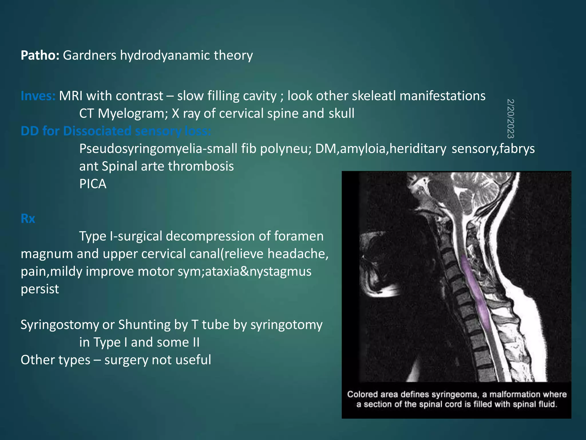 Compressive Myelopathy.pptx