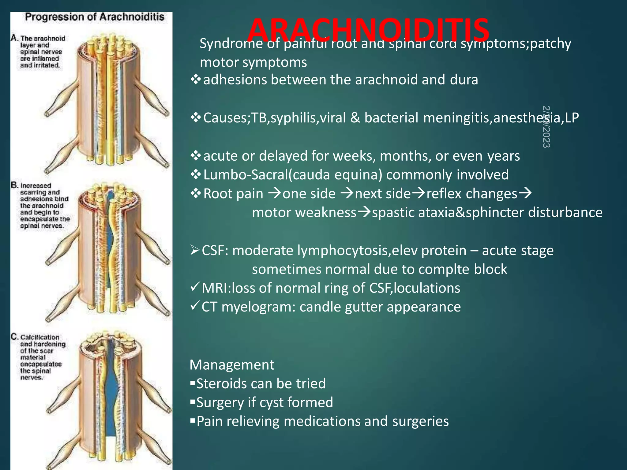 Compressive Myelopathy.pptx