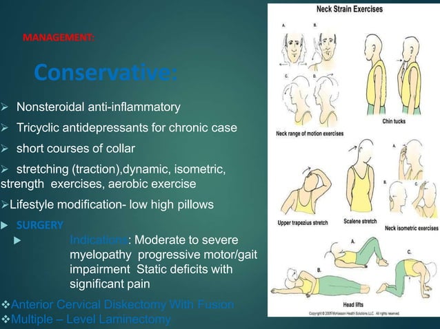 Compressive Myelopathy.pptx