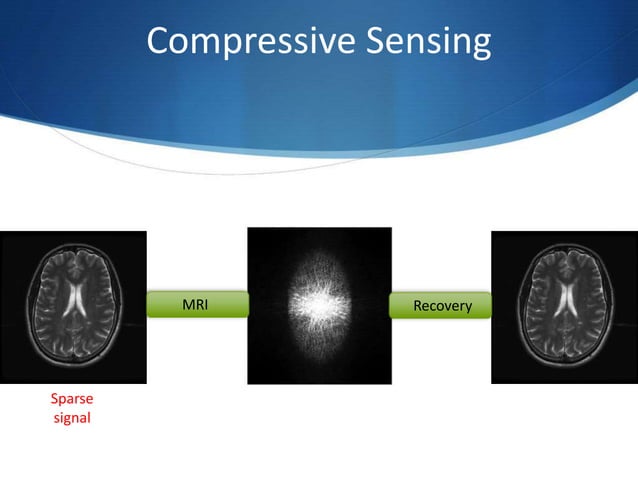 Compressive Sensing Basics - Medical Imaging - MRI | PPTX