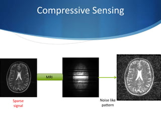 Compressive Sensing Basics - Medical Imaging - MRI | PPTX