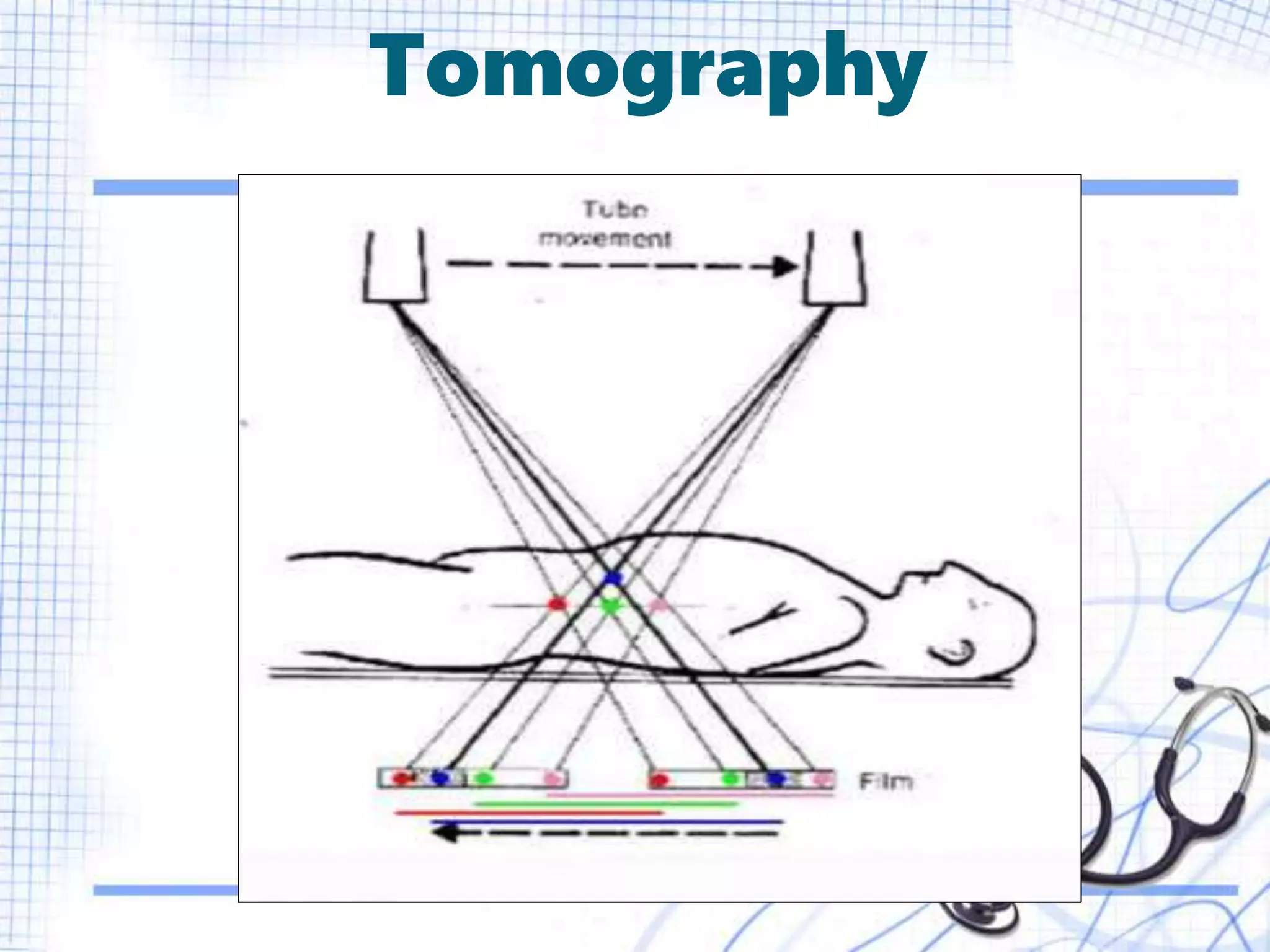 Computed Tomography and Spiral Computed Tomography | PPTX